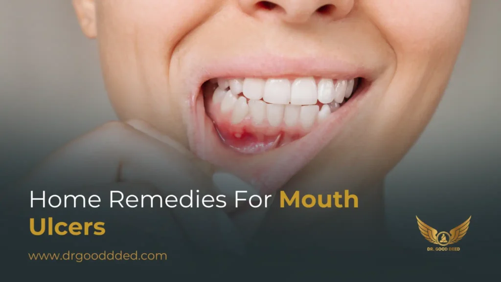 Home Remedies For Mouth Ulcers: Fast Relief, Causes, And What Works