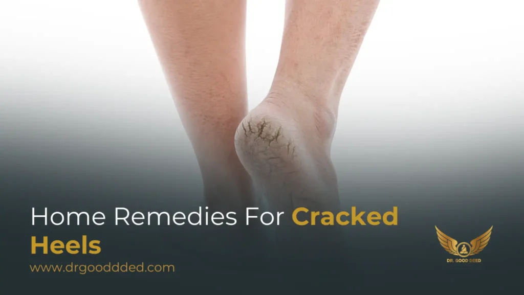 Home Remedies For Cracked Heels: Effective Ways To Heal Dry, Painful Feet