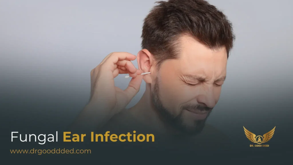 Fungal Ear Infection (Otomycosis): Symptoms, Causes, And Treatment Options