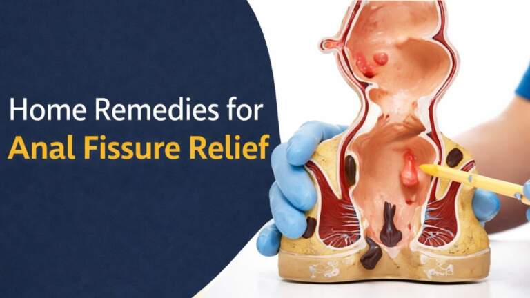 Home Remedies For Anal Fissure: 7 Natural Ways To Relieve Pain